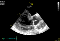 Ultrasounds GIFs - Get the best gif on GIFER