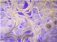 Intestine GIFs - Get the best gif on GIFER