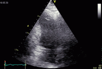 Ultrasound GIFs - Get the best gif on GIFER