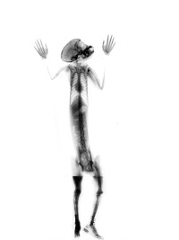 Xray GIFs - Get the best gif on GIFER