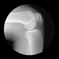 Bone GIFs - Get the best gif on GIFER