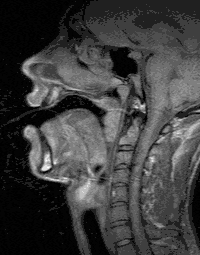 Mri GIFs - Get the best gif on GIFER