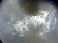 Tuberculosis GIFs - Get the best gif on GIFER