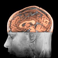 Mri GIFs - Get the best gif on GIFER