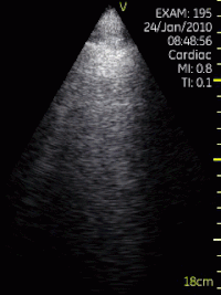 Ultrasound GIFs - Get the best gif on GIFER