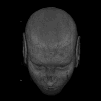 Mri GIFs - Get the best gif on GIFER