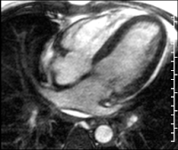 Resonance GIFs - Get the best gif on GIFER