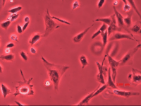 Tumor GIFs - Get the best gif on GIFER