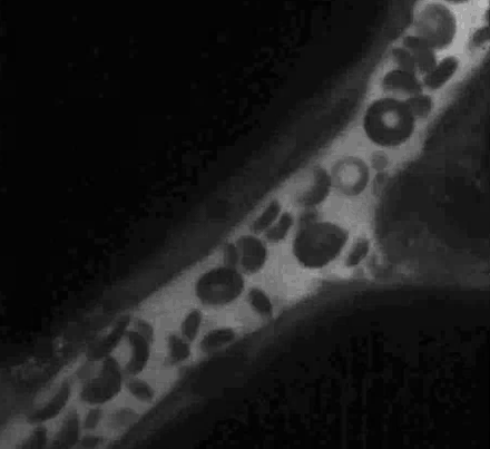 Bloodstream GIFs - Get the best gif on GIFER