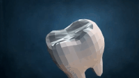 Dental GIFs - Get the best gif on GIFER
