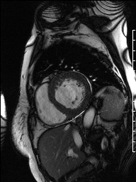 Mrt GIFs - Get the best gif on GIFER