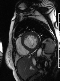 Мрт GIFs - Get the best gif on GIFER