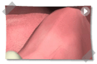 Tooth GIFs - Get the best gif on GIFER