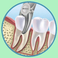 Tooth GIFs - Get the best gif on GIFER