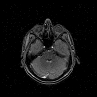 Mri GIFs - Get the best gif on GIFER