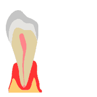 Tooth GIFs - Get the best gif on GIFER