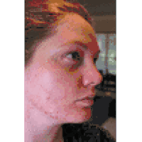 Acne GIFs - Get the best gif on GIFER