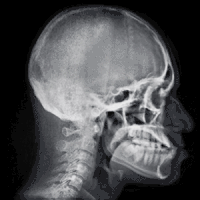 Xrays GIFs - Get the best gif on GIFER