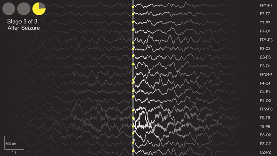 Eeg GIFs - Obtenez le meilleur gif sur GIFER