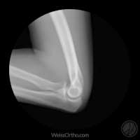 Bones GIFs - Get the best gif on GIFER