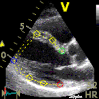 Tracking GIFs - Get the best gif on GIFER