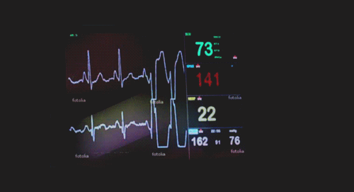 Fetal heartbeat GIFs - Get the best gif on GIFER