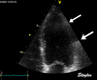 Ultrasound GIFs - Get the best gif on GIFER