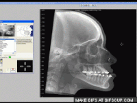 Tracers GIFs - Get the best gif on GIFER