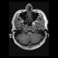 Mri GIFs - Get the best gif on GIFER
