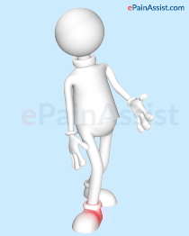 Foot and heel injuries information center GIF - Conseguir o melhor gif ...