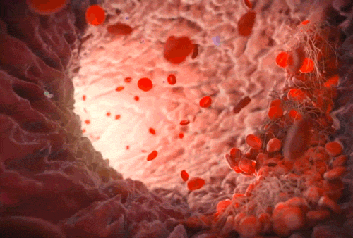 Leukemia гифки, анимированные GIF изображения leukemia - скачать гиф ...