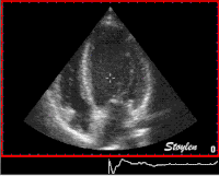 Echocardiography GIFs - Get the best gif on GIFER