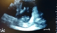 Ultrasound GIFs - Get the best gif on GIFER