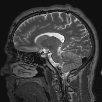 Mri scan GIFs - Get the best gif on GIFER