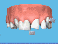 Dental GIFs - Get the best gif on GIFER