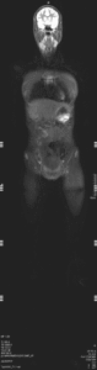 Mri GIFs - Get the best gif on GIFER