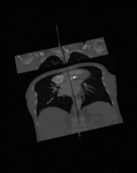 Scan GIFs - Get the best gif on GIFER