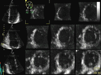 Ultrasound GIFs - Get the best gif on GIFER