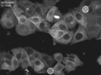 Cancer GIFs - Get the best gif on GIFER