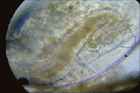 Digestion GIFs - Get the best gif on GIFER