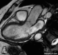 Resonance GIFs - Get the best gif on GIFER