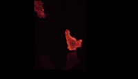 Immunology GIFs - Get the best gif on GIFER