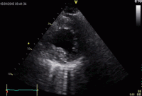 Ultrasound GIFs - Get the best gif on GIFER