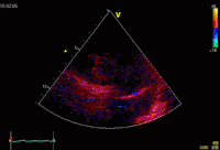 Ultrasound GIFs - Get the best gif on GIFER