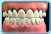 Teeth GIFs - Get the best gif on GIFER