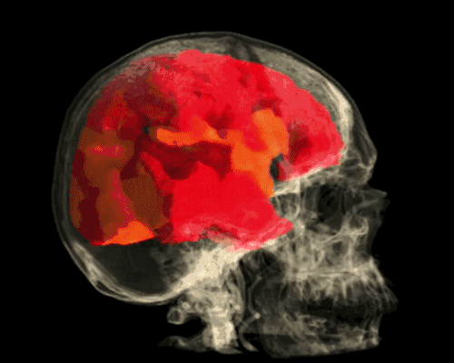 Fmri GIFs - Get the best gif on GIFER