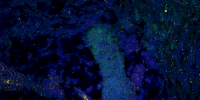 Digestion GIFs - Get the best gif on GIFER