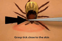 Ticks GIFs - Get the best gif on GIFER