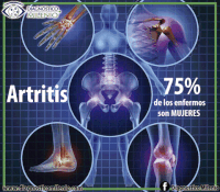 Arthritis GIFs - Get the best gif on GIFER
