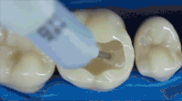 Tooth GIFs - Get the best gif on GIFER